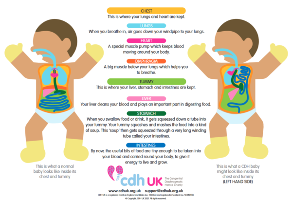 Helpful Resources - CDH UK